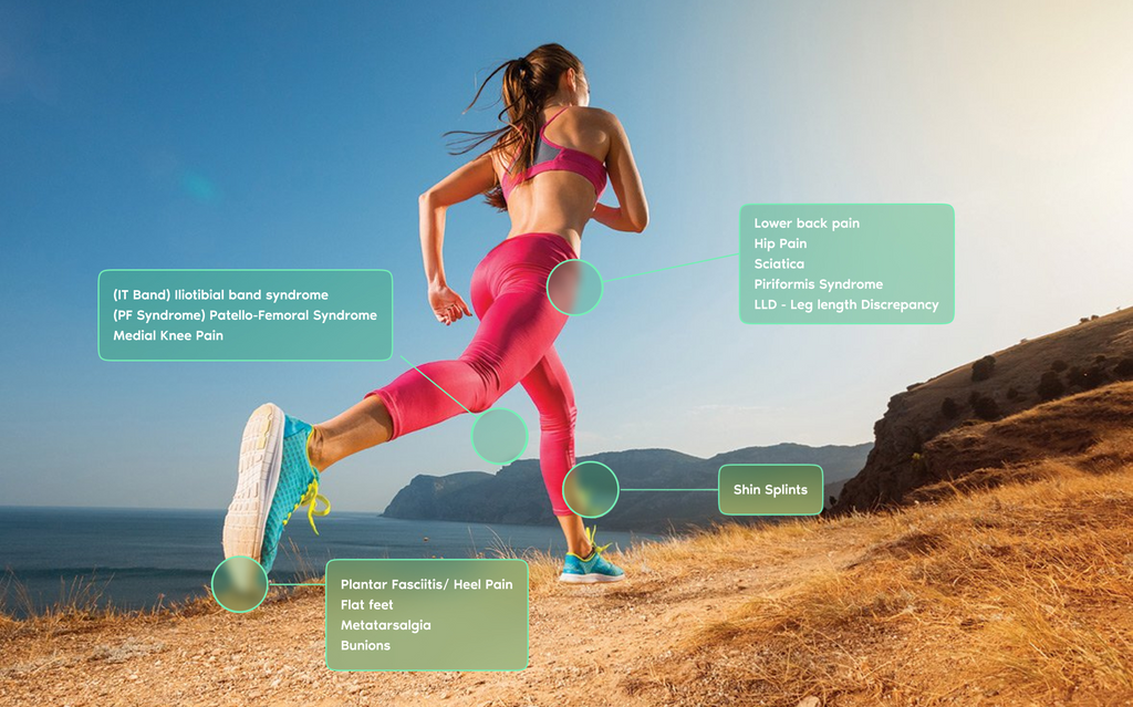 Get Custom Orthotics | Orthotics Direct